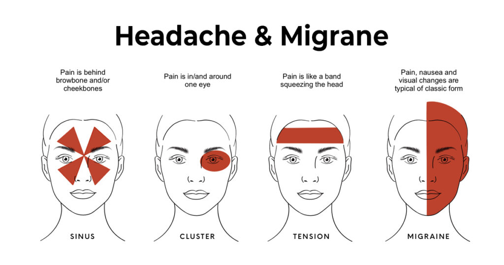 Headache & Migrane - Union Yoga Ayurveda
